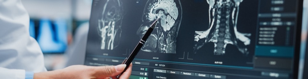 What Are Acceleration-Deceleration Injuries in Pennsylvania?