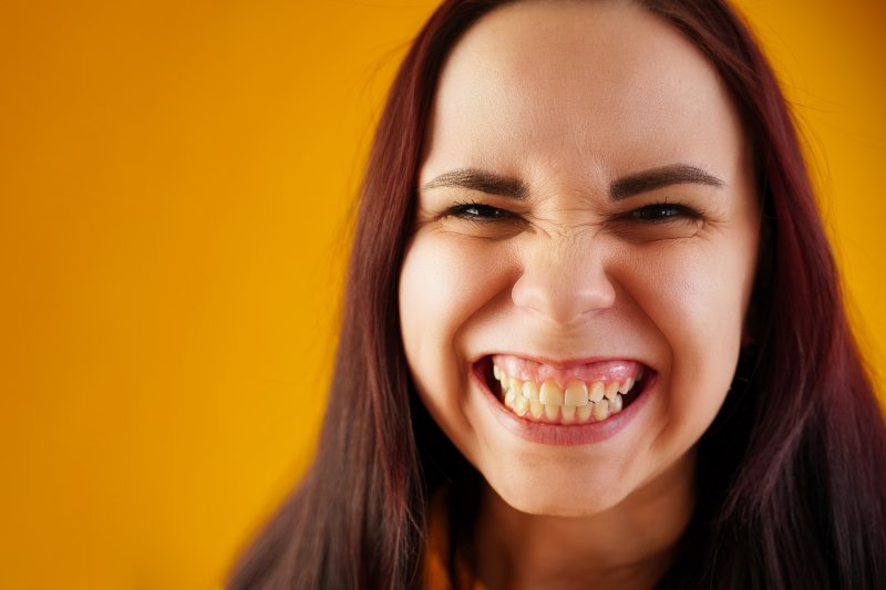 Can Invisalign Fix Overbite?: 5 Things You Should Consider