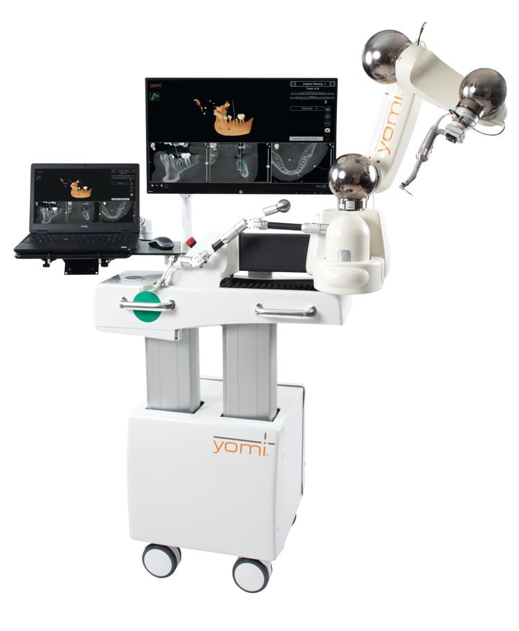 YOMI Robotic Guided Dental Implant Technology | 360 Family Dental