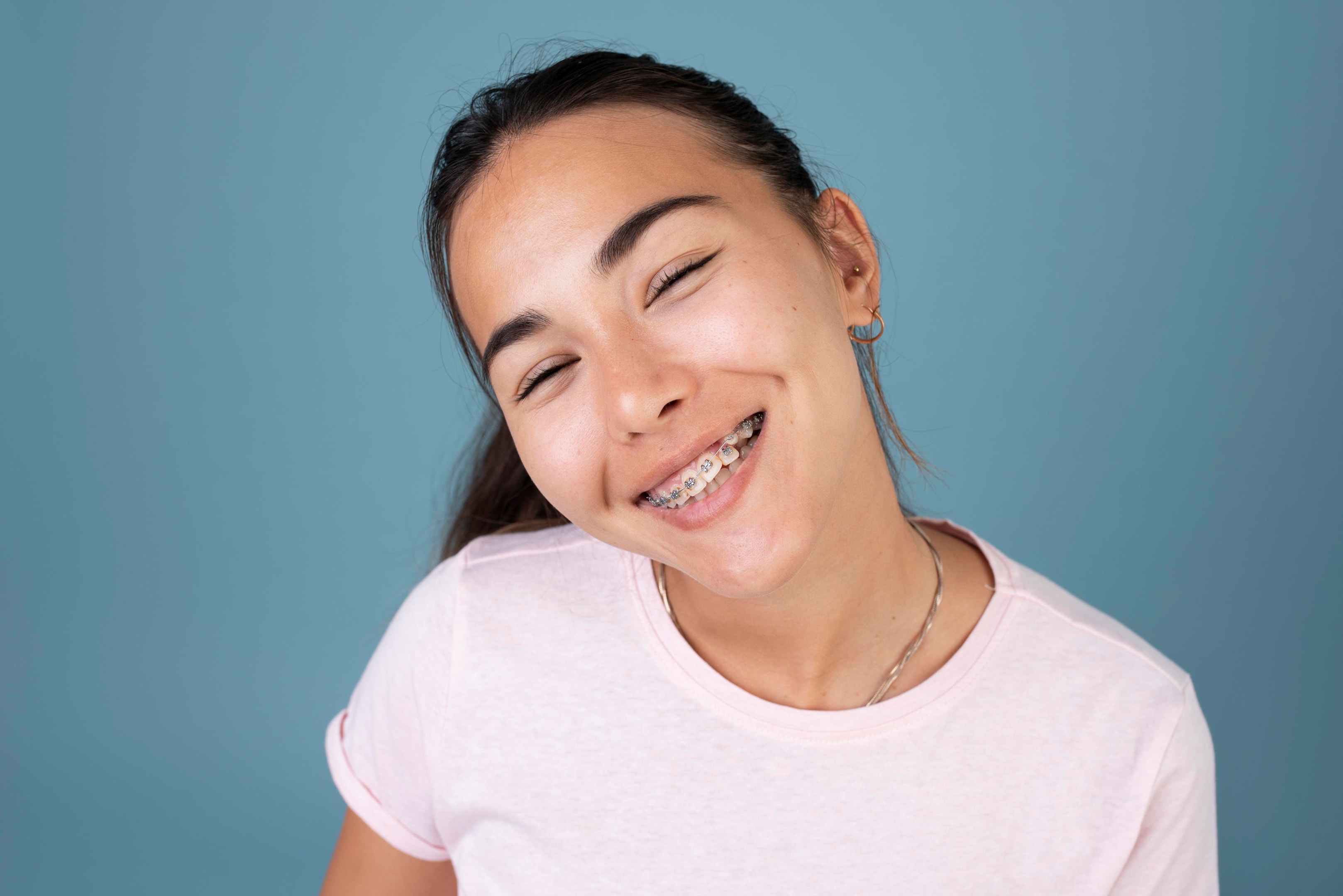 Student Braces Singapore: 4 Types, Benefits, and Costs