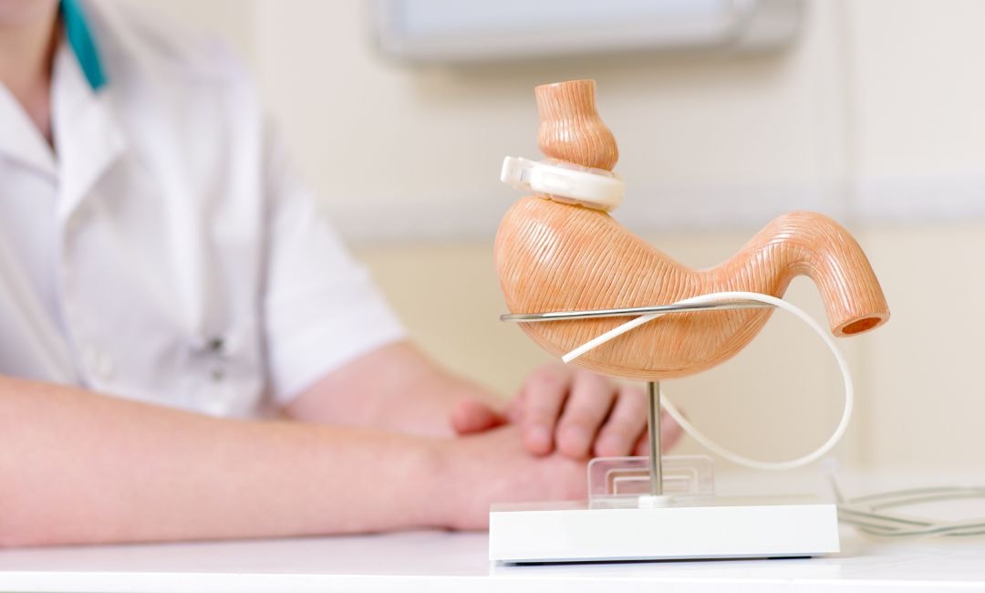 Understanding the Lap Band Surgery Procedure: Benefits and Insights ...