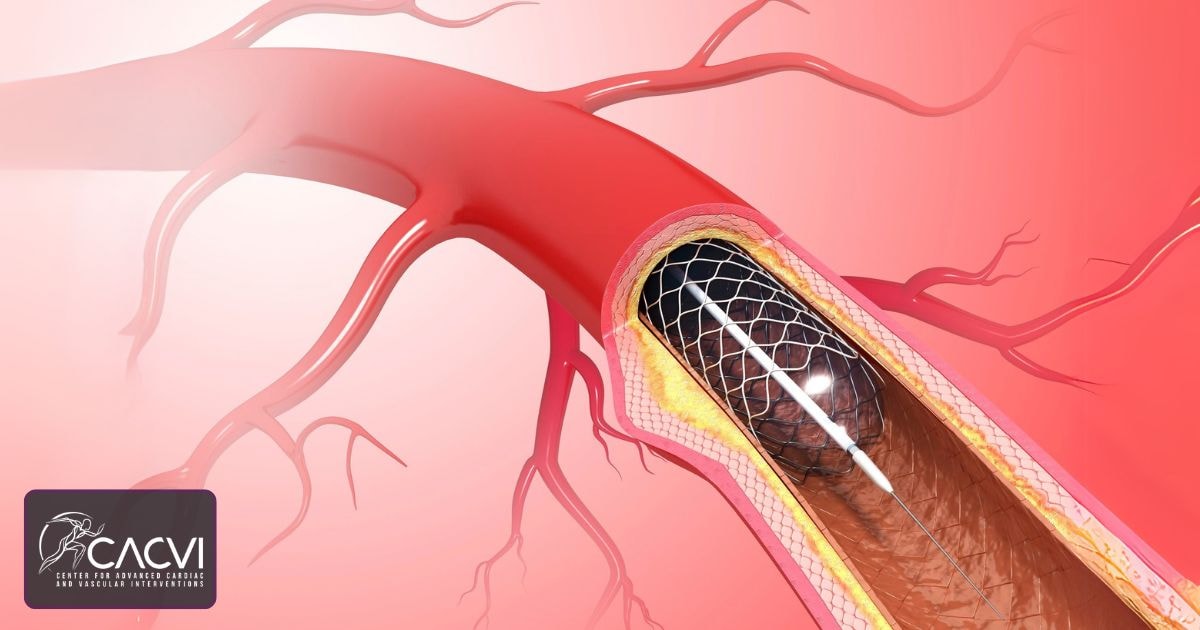What Is a Vascular Doctor and Why You Might Need One?