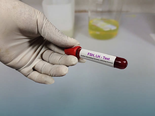 Causes of Irregular Periods and Essential Diagnostic Tests – MyDiagnostics