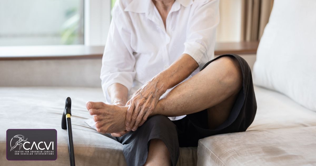 Symptoms of Nerve Damage After Varicose Vein Surgery (2025)