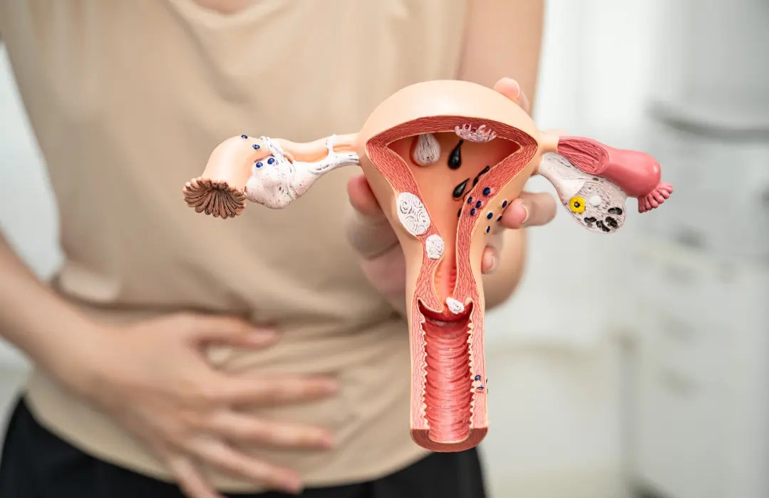 Fibroids and Menopause: Causes, Symptoms & Treatment Options - medagg