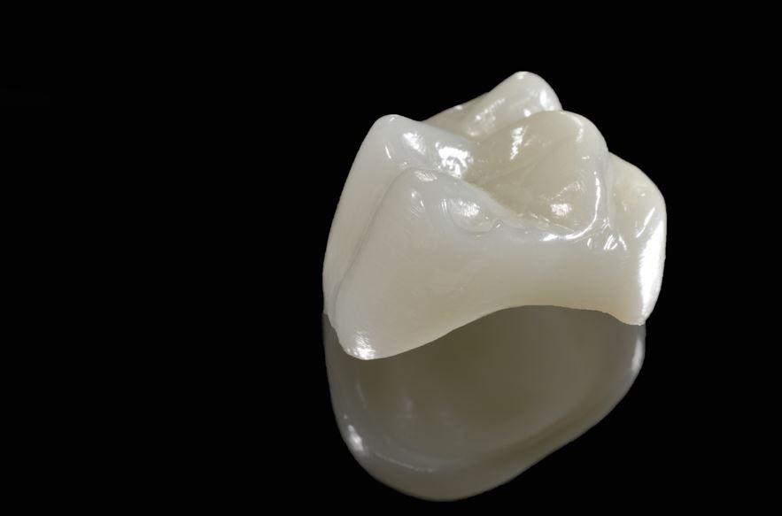 Dental Crown Comprehensive Guide | 360 Family Dental